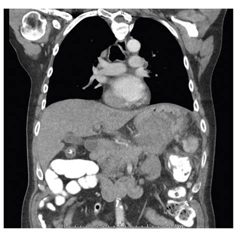 Axial Ct View Showing The Large Gastric Mass Download Scientific Diagram