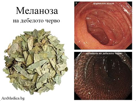 Ниацин витамин В3 никотинова киселина Arsmedica Bg