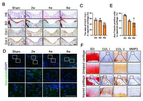 Sci Adv 南京大学医学院附属鼓楼医院史冬泉教授团队发现软骨修复新策略“纤维软骨透明化”在软骨损伤治疗中的潜能 公司新闻 上海吉凯基因医学科技股份有限公司