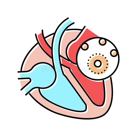 Ilustración Vectorial Del Icono Del Color De La Enfermedad Miocarditis