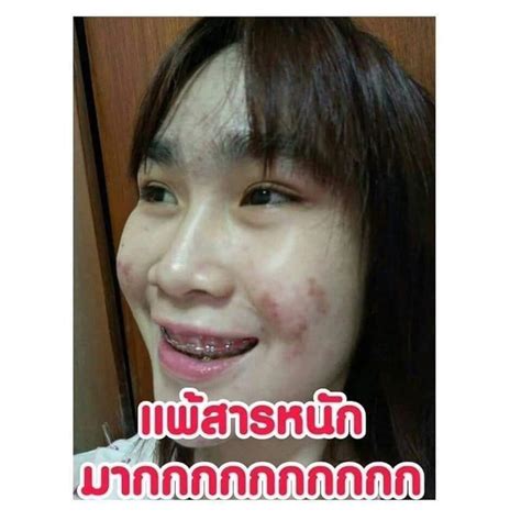 เซรั่มอเมท เซรั่มอเมทิสต์ ส่งฟรีปลายทางพร้อมส่ง เพจบริษัท