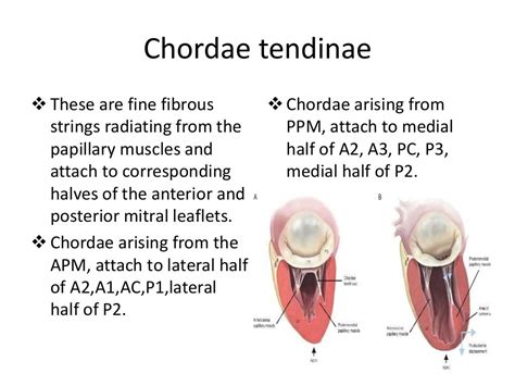 Assessment Of Mitral Valve By Tee