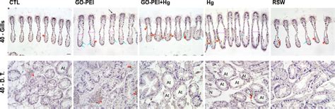 Histopathological Alterations Present In Gills At Salinity 40