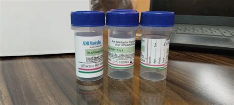 Liquid Based Cytology Service Thinprep At ₹ 75piece In Sonipat Id 2854259091448