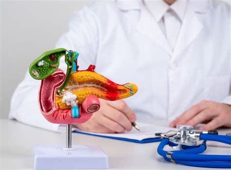 Avances en el Diagnóstico y Tratamiento del Cáncer de Páncreas