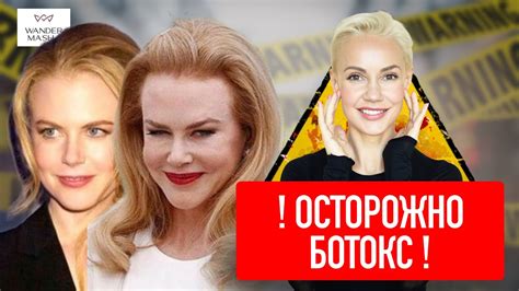ПОБОЧНЫЕ ЭФФЕКТЫ от ботокса Youtube