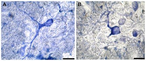 Unipolar Neuron Under Microscope