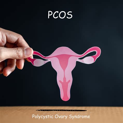 Pcos Screening Chemhealth Diagnostics