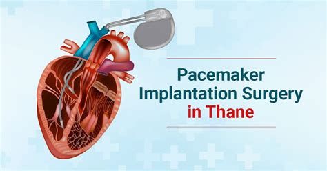 Complete Guide To Heart Pacemaker Surgery At Jinkushal Hospital In Thane