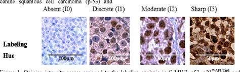 Figure 1 From Insertion Of The Line 1 Element In The C Myc Gene And