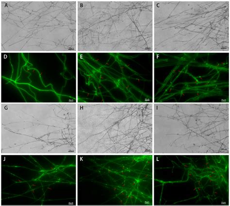Microscopic Morphology Of The Mycelium Of Lentinula Edodes Le And Download Scientific Diagram