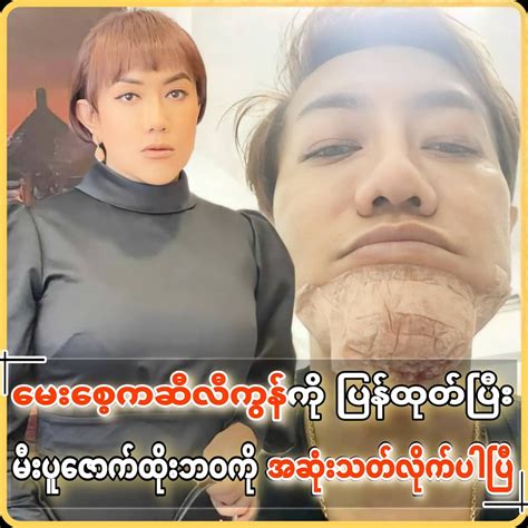 မေးစေ့က ဆီလီကွန်ကိုပြန်ထုတ်ပြီး မီးပူဇောက်ထိုးဘဝကို အဆုံးသတ်လိုက်ပါပြီ သုရဲ့မျက်နှာက