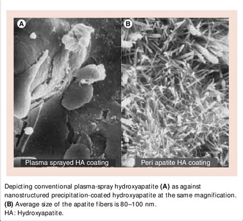 Scanning Electron Microscope Images Download Scientific Diagram