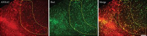 Morphologies Of Microglia Labeled By Anxa3 And Anxa3 Protein Expression