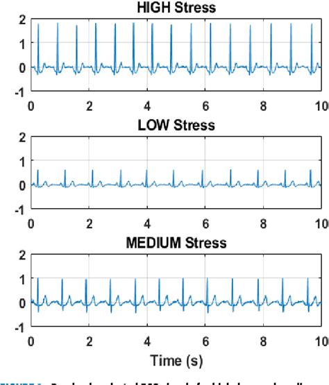 Figure 1 From Ecg Based Drivers Stress Detection Using Deep Transfer Learning And Fuzzy Logic
