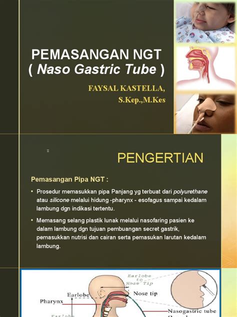 Pemasangan Ngt And Memberi Makan Melalui Ngt Pdf