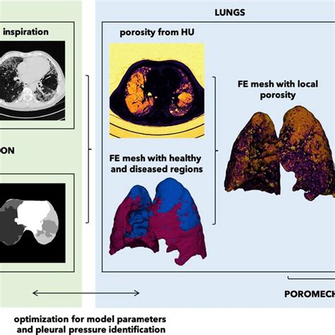 Schematic Representation Of The Personalized Lung Modeling Pipeline Download Scientific Diagram