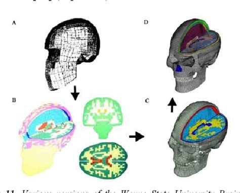 Figure From A Review Of Head Injury And Finite Element Head Models