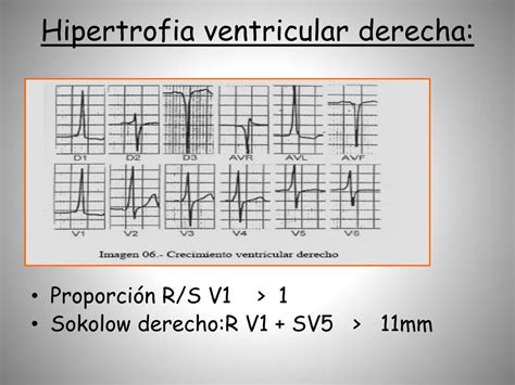 Ppt Apuntes BÁsicos De ElectrocardiografÍa Powerpoint Presentation