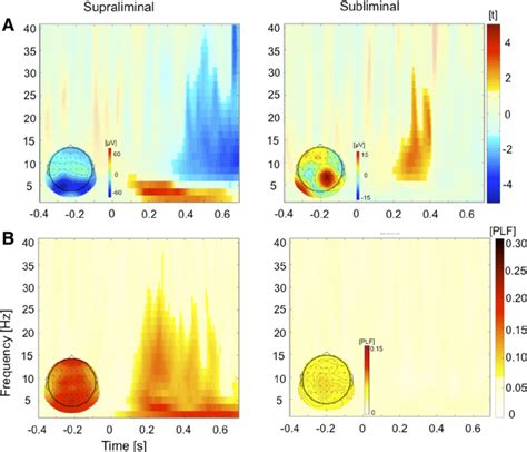 Analysis Of Oscillatory Power A Time Frequency Representation Of