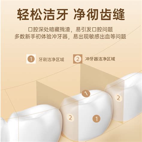 德国jimok锦美客电动冲牙器便携式家用正畸洗牙器水牙线声波清洁虎窝淘