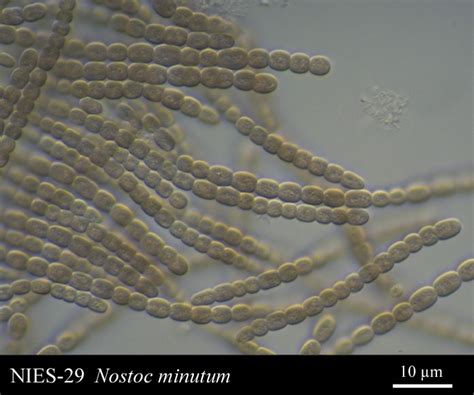 Nostoc Minutum Diatomeas Celulas