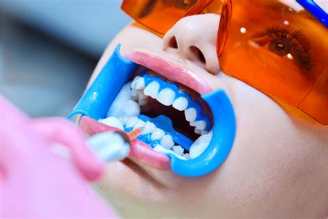 Teeth Whitening The Myths And Truths You Need To Know Moyens Io
