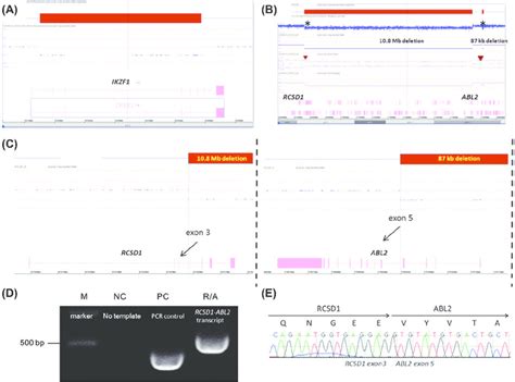 Copy Number Abnormalities Detected By Chromosomal Microarray Analysis