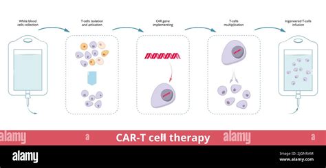 Car T Cell Therapy Chimeric Antigen Receptor T Cells Are T Cells That