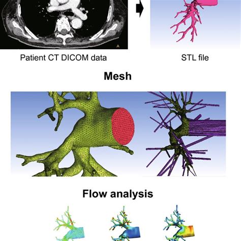 The Expanded Denver Screening Criteria For Bcvi Download Scientific