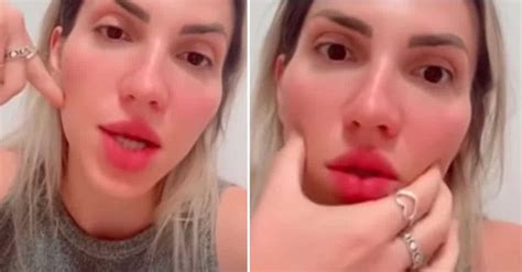 Tiktoker Si Pente Di Aver Subito La Bichectomia Mi è Caduta La Faccia