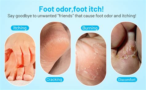 Healmusz Athletes Foot Sprayfoot Fungus Treatmentathletes