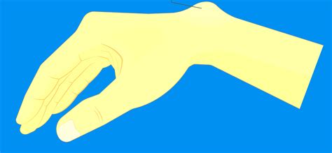 Ganglion Cyst Upswing Health Upswing Health