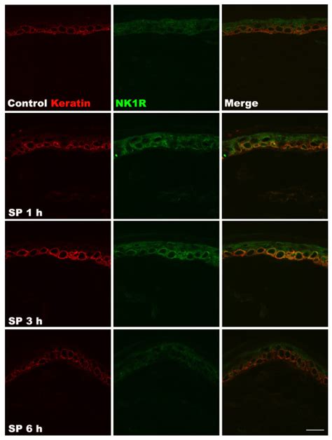 Labeling For Keratin Protein And The Nk1 Receptor Nk1r In The Hindpaw