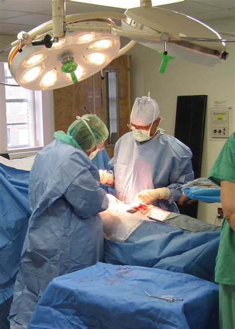 Cesarean Debate Now Important Information The Nice C Section Handout For