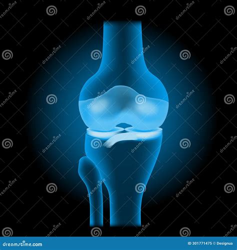 Knee Joint Anatomy Stock Vector Illustration Of Patient 301771475