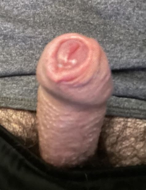 Hairy Uncut Cock Pics Xhamster