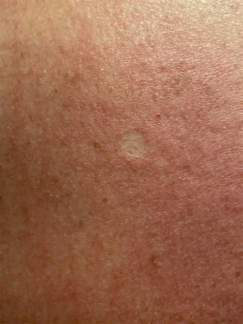 Help Identifying Please R Dermatologyquestions