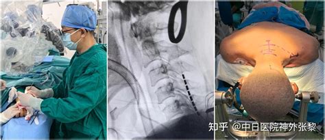 关爱昏迷患者，聚焦 世界昏迷日” 知乎