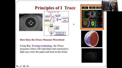 Lecture Wavefront Aberrometry And Itrace Screening And Planning Surgeries Youtube