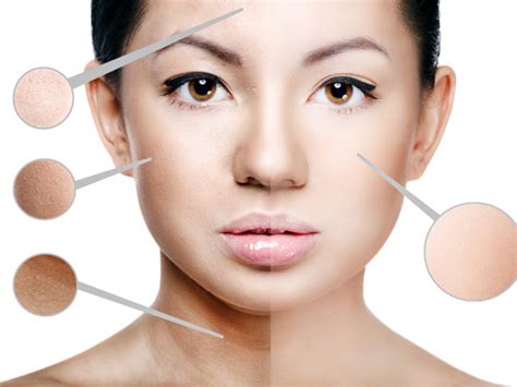 Lifestyle Factors Affecting Skin Health