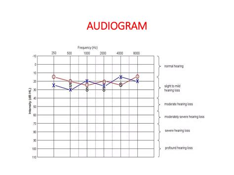 Functional Assessment Of Hearing And Vestibular Function Tests Pptx