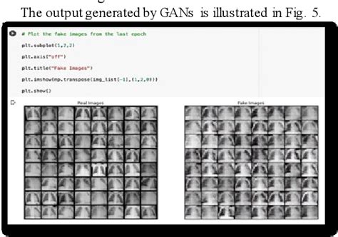 Figure 2 From Lung Disease Detection From Chest X Ray Using Gans Semantic Scholar