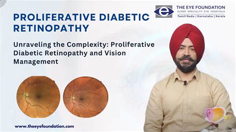 Proliferative Diabetic Retinopathy Expert Treatment At The Eye