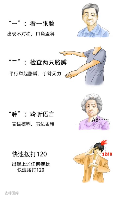 脑梗死 医学插画