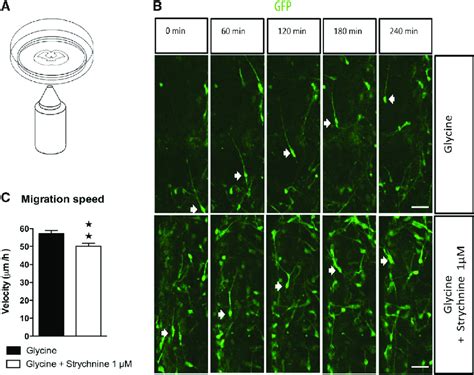 Glyr Blockade Reduces Interneuron Migration Speed In Brain Slices A Download Scientific
