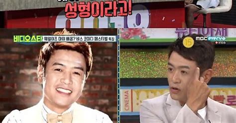 비디오스타 김지민 김대희 성형 폭로 화가 난 줄 알았다