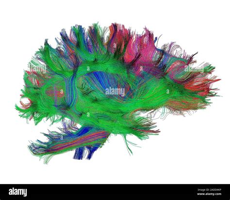 Diffusion Tensor Imaging DTI Scan Reconstructed Brain White Matter