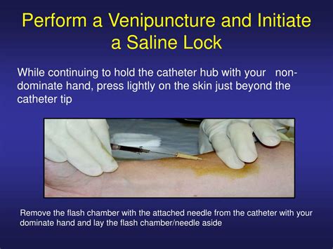 Ppt Initiating A Saline Lock And Intravenous Infusion Powerpoint