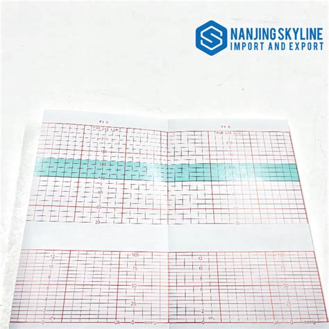 Hospital Medical Ctg Paper 152 90mm For Comen Star5000d 5000f C20 Buy Ctg Paper 152 90mm Ctg